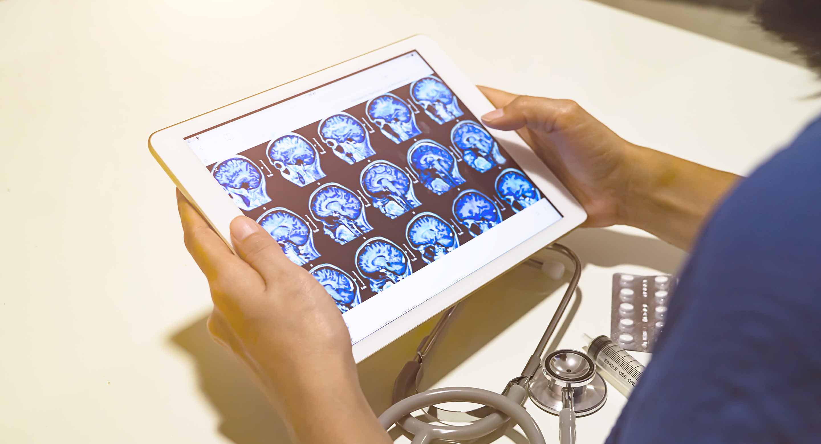 CAMH develops potential new drug treatment for multiple sclerosis | CAMH CAMH develops potential new drug treatment for multiple sclerosis | CAMH